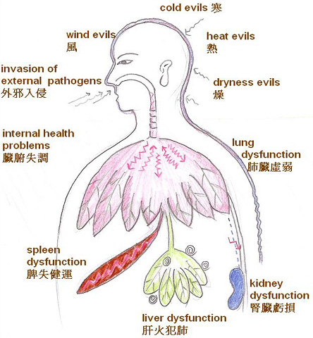 How Traditional Chinese Medicine Sees Coughing